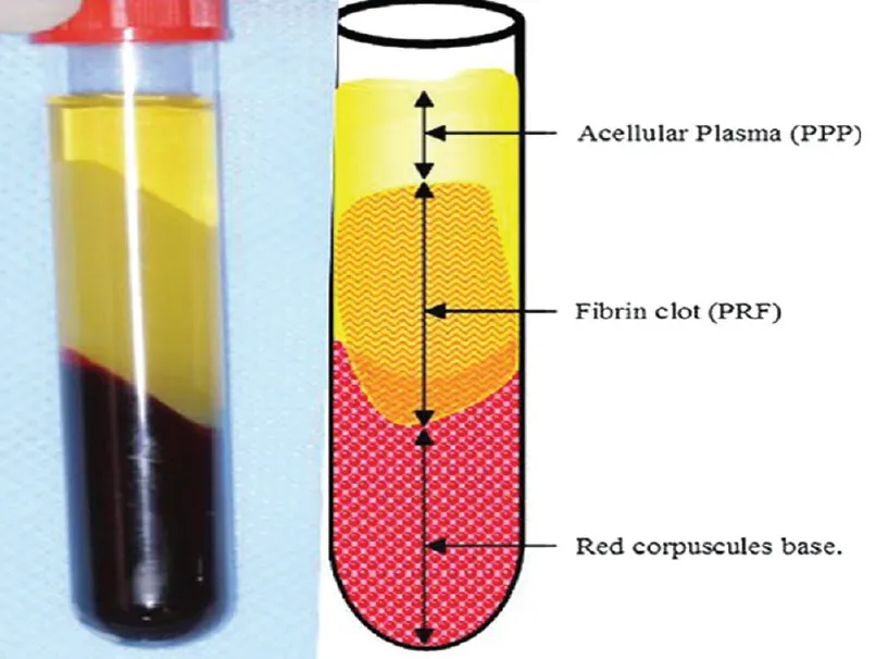 PRF Pleasant Grove UT, Dr. Rod Maxfield, DDS
